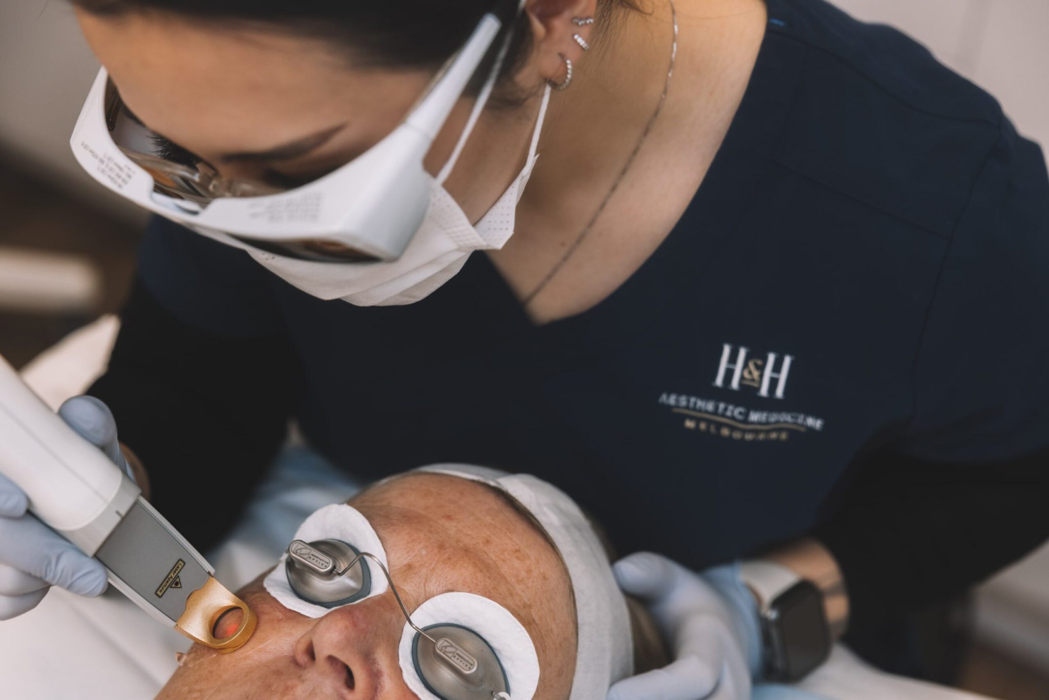 Laser Treatment for Pigmentation | H&H Aesthetic Medicine